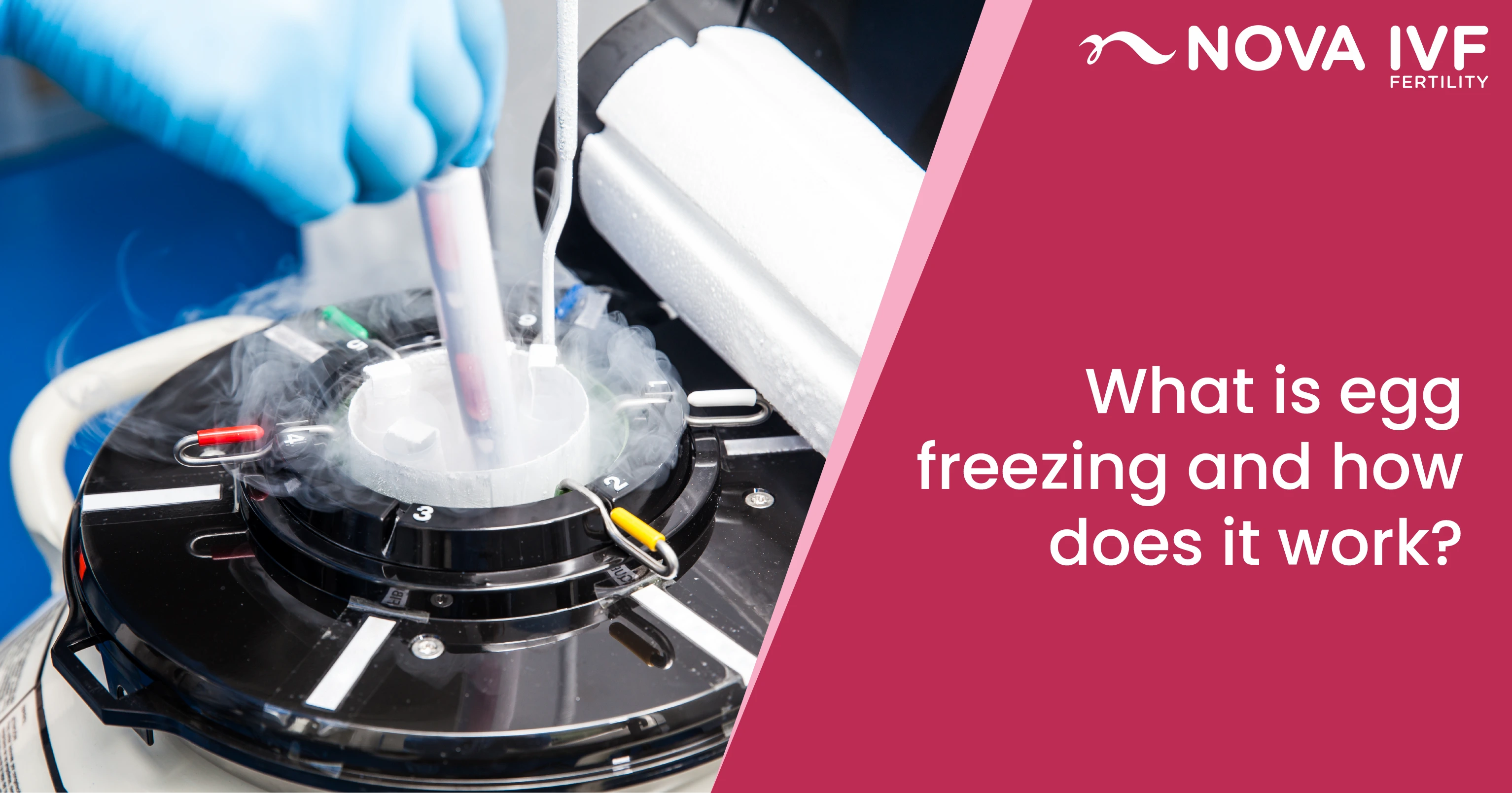 Egg Freezing Process: The Ultimate Step-by-Step Process Guide | Nova IVF Fertility
